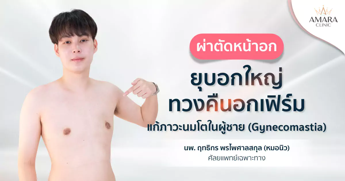 ผ่าตัดหน้าอก แก้ภาวะนมโตในผู้ชาย (Gynecomastia)